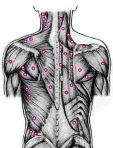 Lower Back Pain Right Side: Causes and Best Natural Solutions