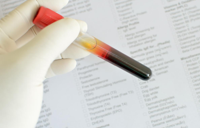 'Sticky Blood': More Dangerous for Your Heart Than Cholesterol ...